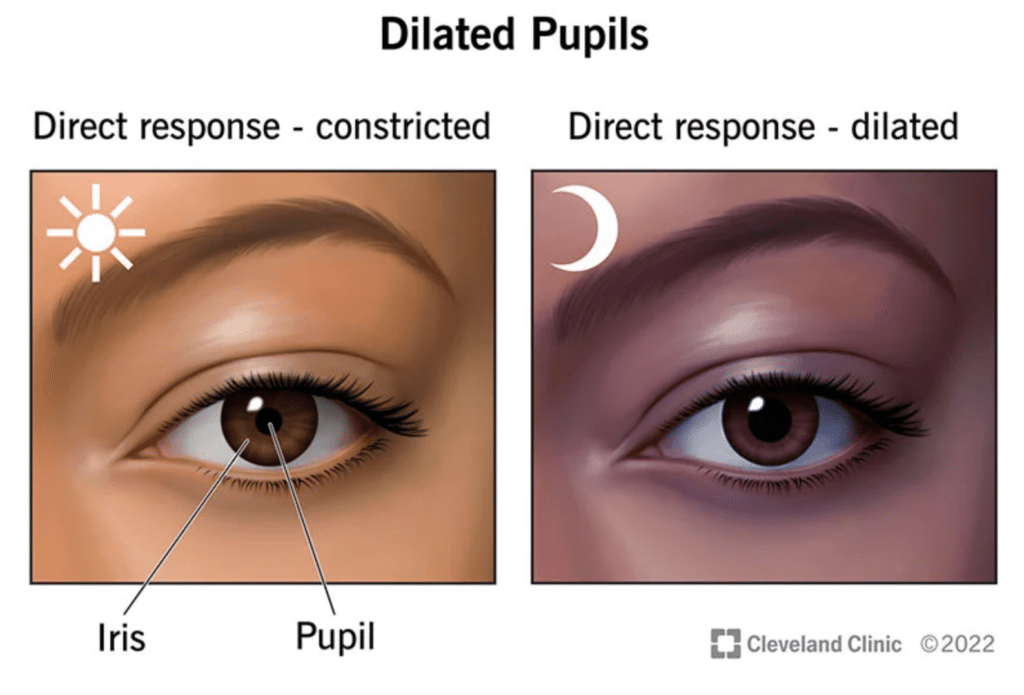 Dilated Pupils - Clarity Eye Center